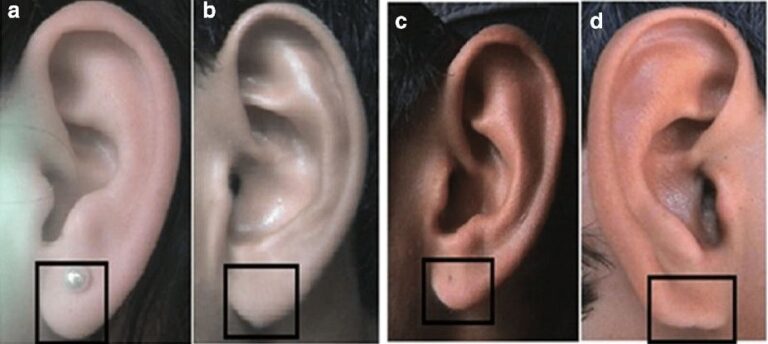 10 Best Earrings for Thick Earlobes in 2021 | Complete Guide - Piercinghome